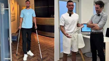 Rotura de piernas: el doloroso procedimiento de un 'influencer' para ...