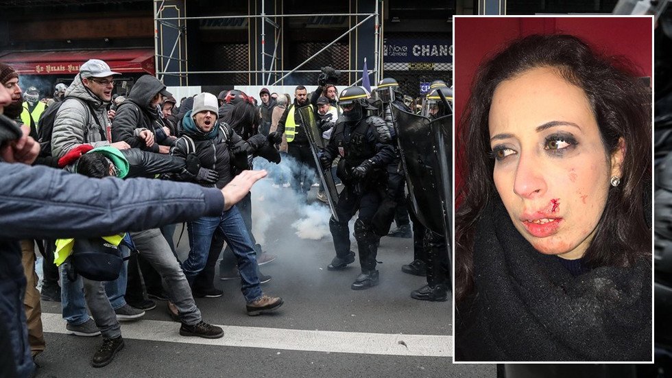 RT France reporter struck in face covering Yellow Vest protest — RT ...