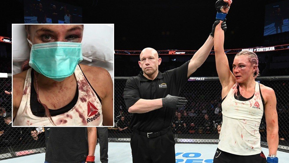 Russian MMA star Yana Kunitskaya to sell 'gorgeous' bloodied UFC shirt ...