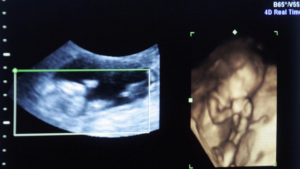 US abortion doctor stashed over 2,000 ‘preserved’ fetal remains at his ...