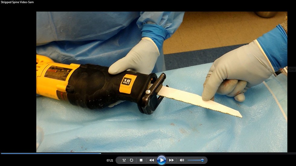Human chop shop: Body donation center made Frankenstein cadavers, US ...