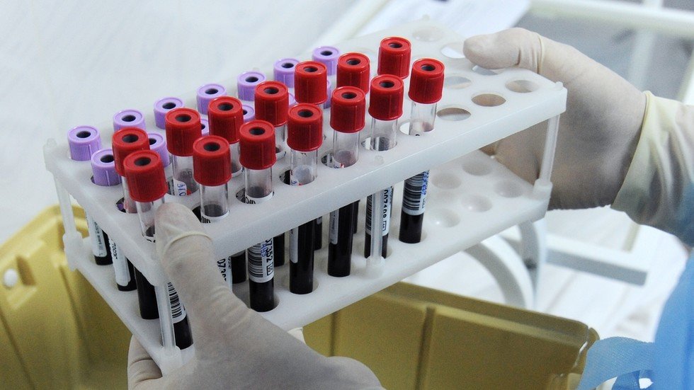 Result in just minutes: Russian scientists discover way to diagnose ...