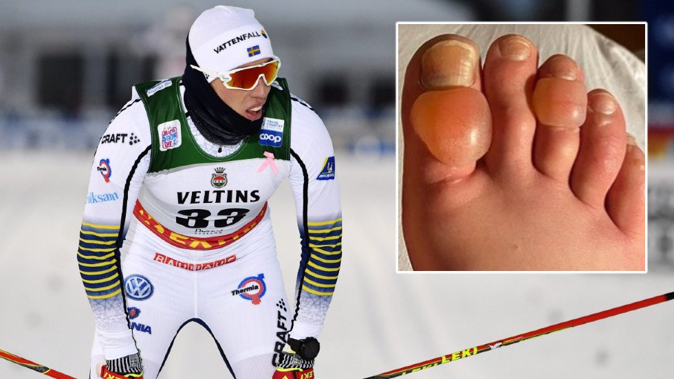 ‘It was really bad’: Ski star admits to frozen penis nightmare after ...