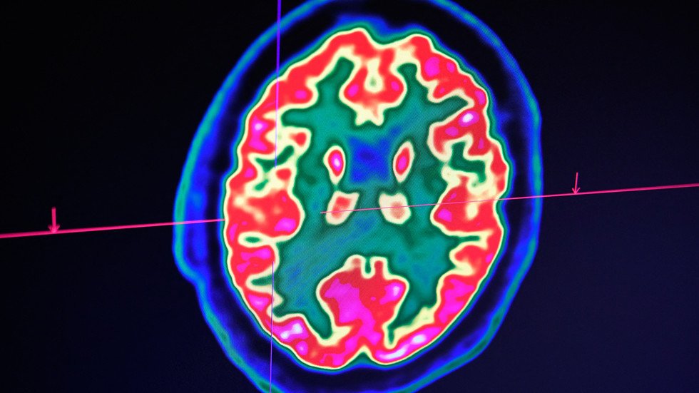 ‘Zombie gene’ causes brain cells to come alive & grow appendages HOURS ...