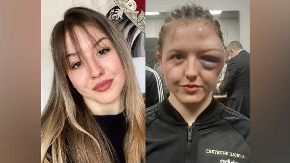 ‘Before and after’: German boxing starlet Cheyenne Hanson shows off ...