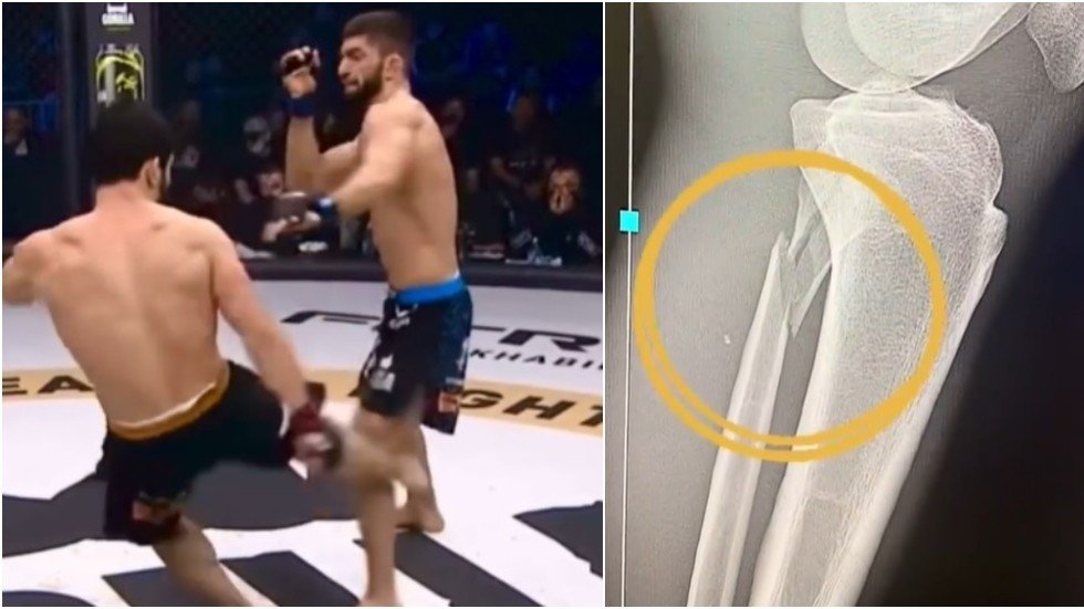 ‘I joked I wasn’t in pain. At that moment, he broke my leg’: Russian ...