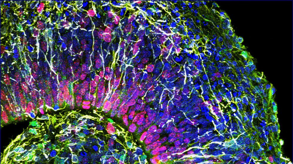 Scientists force human brain cells into Matrix-like simulation — RT ...