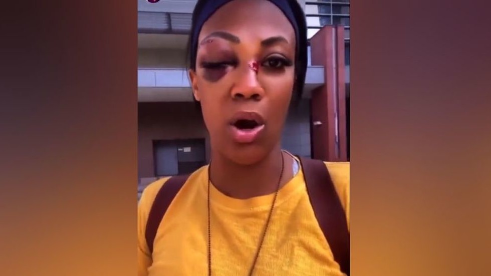 US Olympian ‘almost blinded’ after savage assault (VIDEO) — RT Sport News