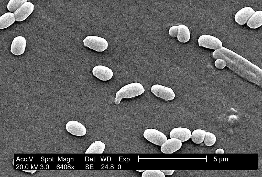 RDC : l’anthrax refait surface au Nord-Kivu avec le signalement de 8 ...